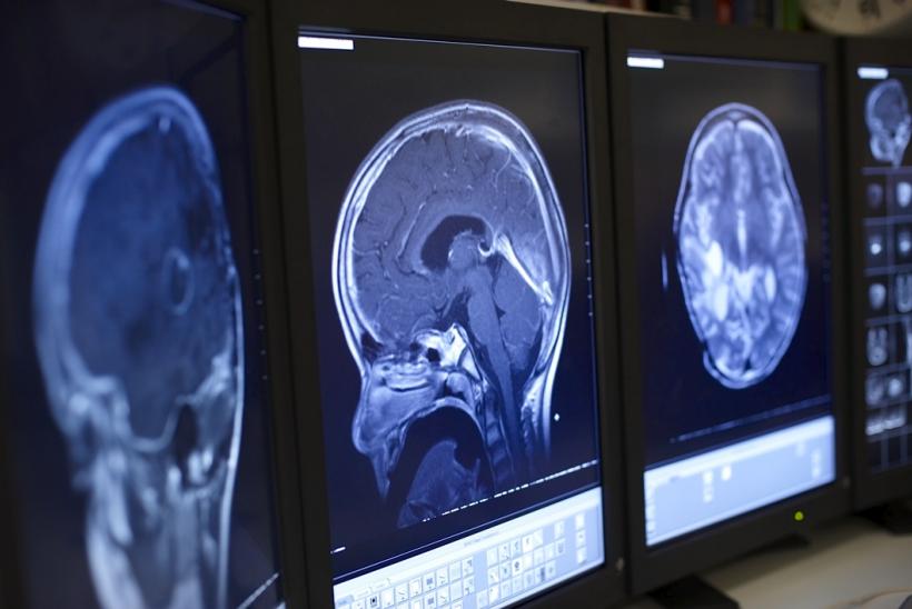 Neurology | International and Private Care - GOSH