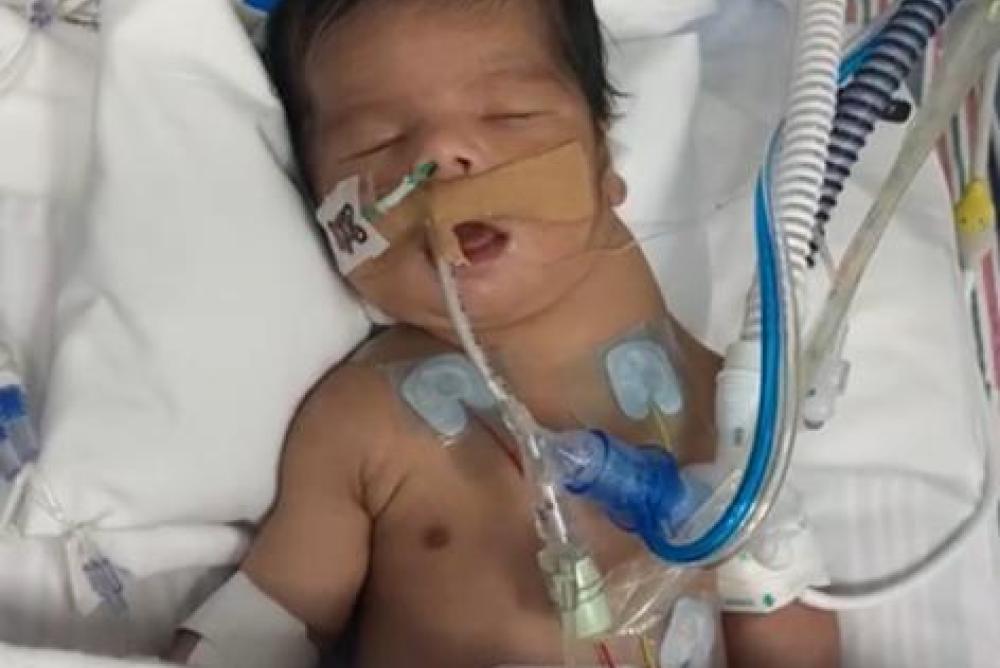 Baby Omar's Triumph over Rare Complications | International and Private ...